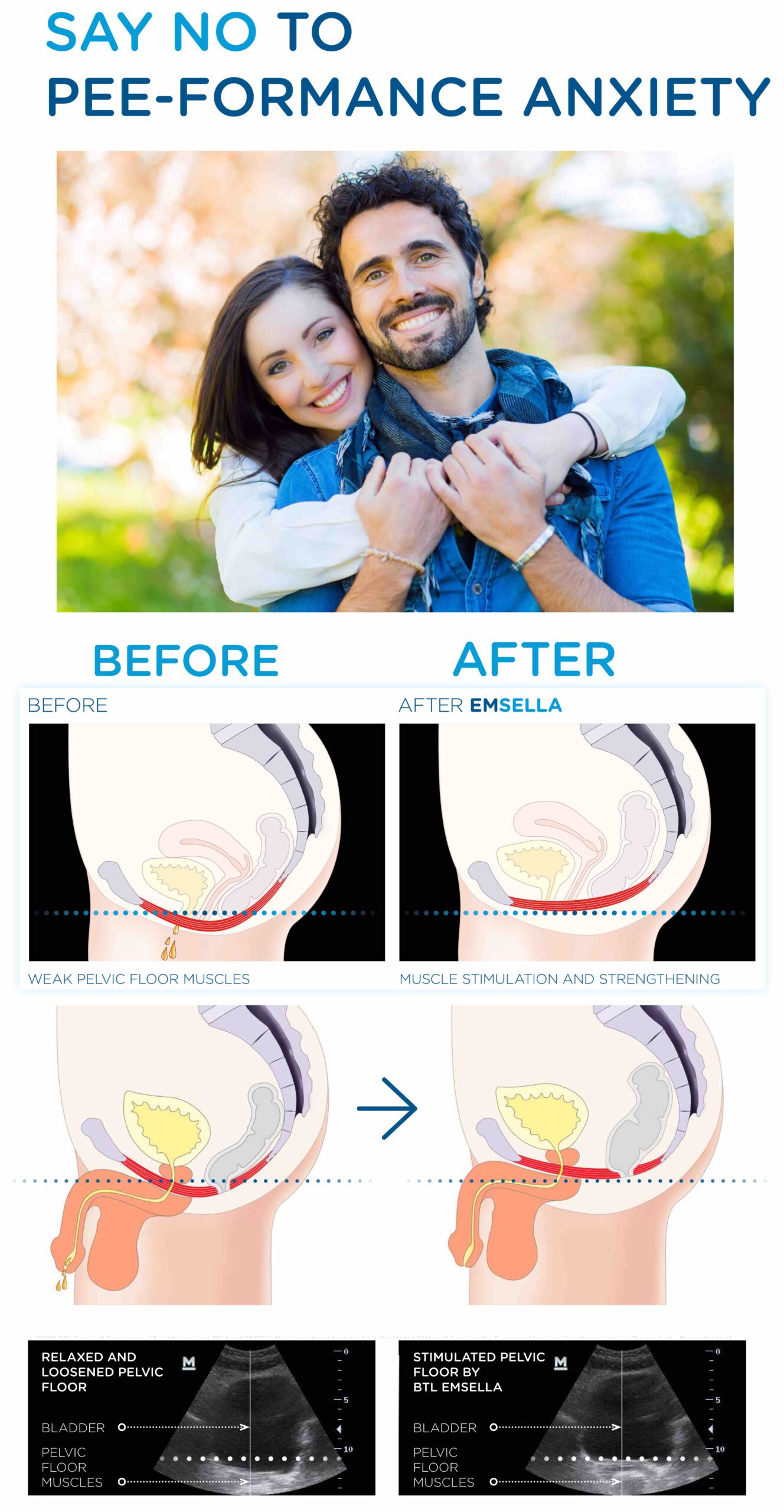 EMSELLA® Chair - Kegel Throne Therapy - VitalityMD Toronto